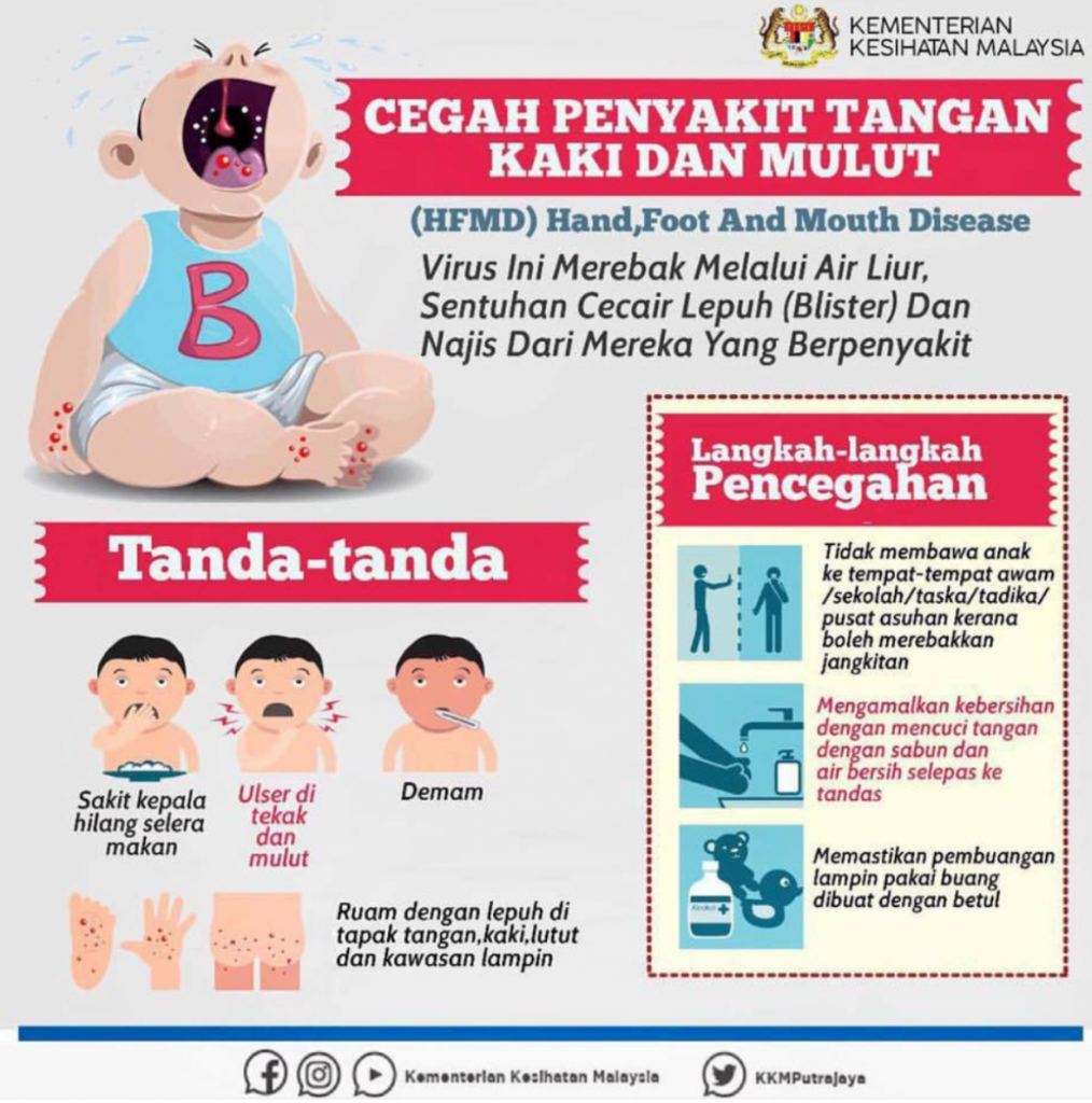 Anak Dijangkiti HFMD Kena Elak Makanan & Minuman Panas- Pakar
