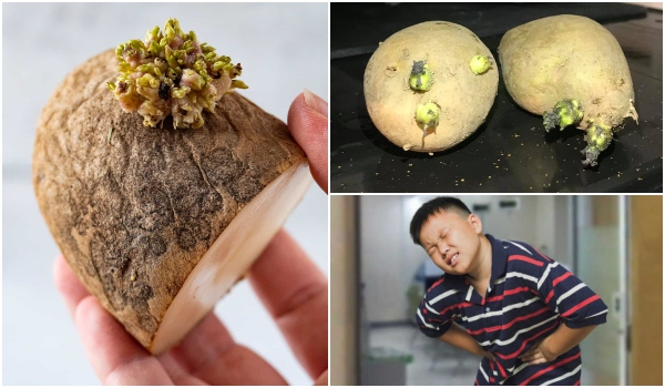 Kentang Dah Bertunas Jangan Makan! Ada Kandungan Berbahaya & Ini Kesannya