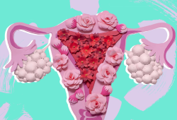 PCOS, Cyst & Fibroid, Semua Tak Sama, Kenali Perbezaannya