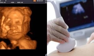 Scan Perut Ibu Hamil, Ketahui Apa Sebenarnya Boleh Jumpa!