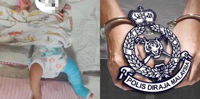 Kes Dera Bayi 2 Bulan Hingga Patah Kaki, Pengasuh Ditahan