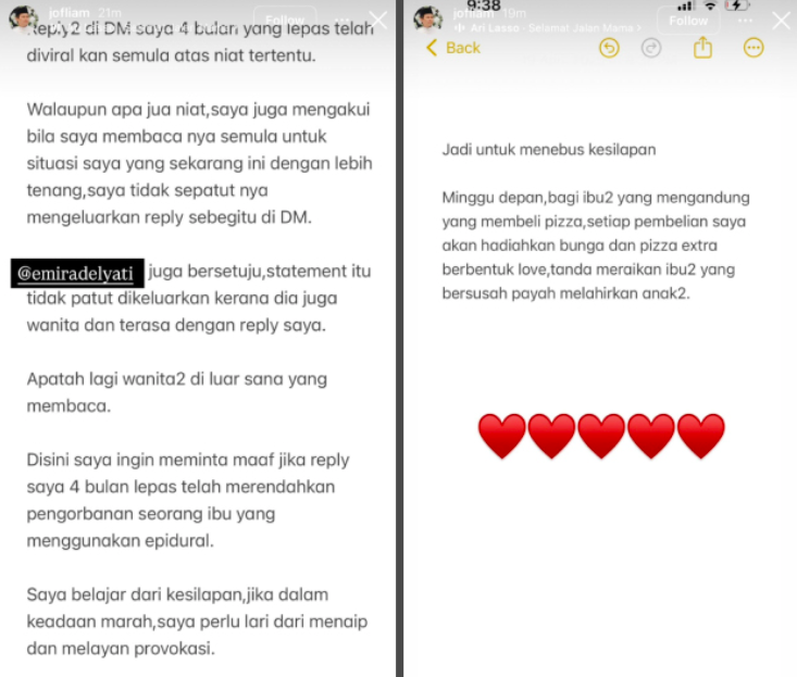 Jofliam Minta Maaf, Perlekeh Cik Epal Bersalin Guna Epidural