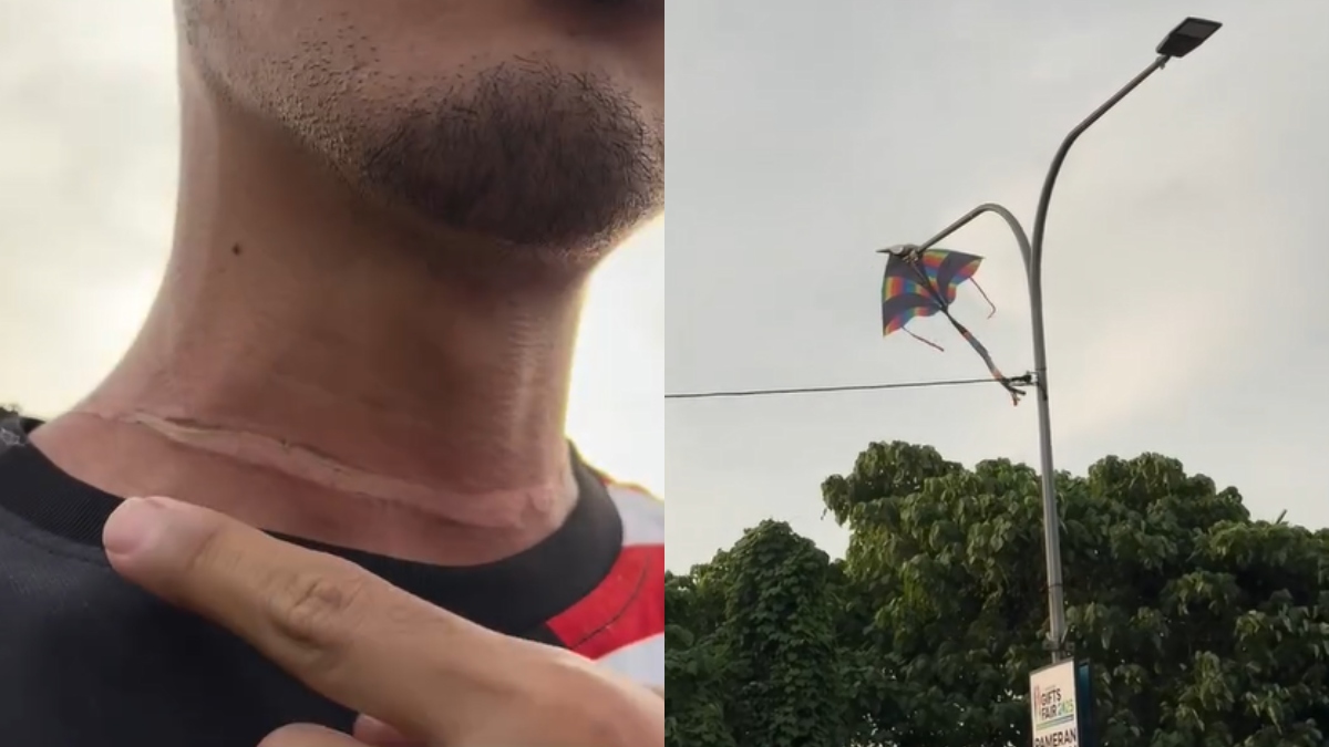 Tali Layang-Layang Terlilit Leher, Penunggang Nyaris Maut!