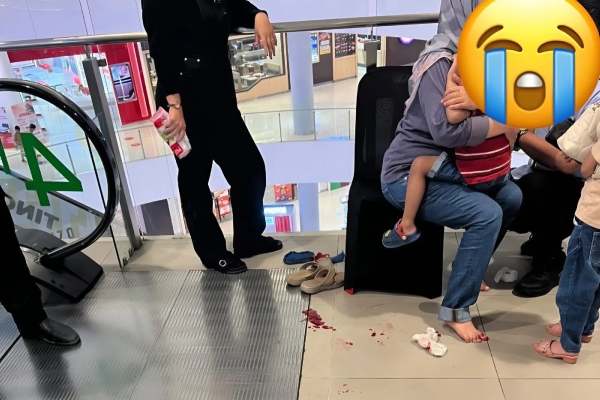 Insiden Eskalator Aman Central, Sampai Kaki Budak Tersiat