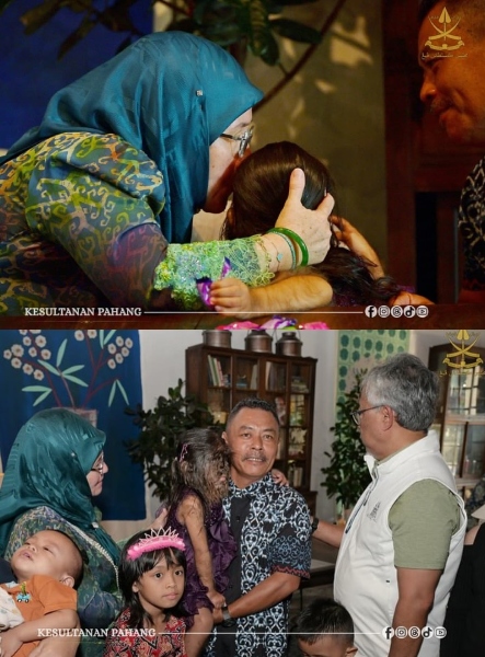 Penghidap Sindrom Werewolf, Missclyen Kini Masuk Prasekolah!