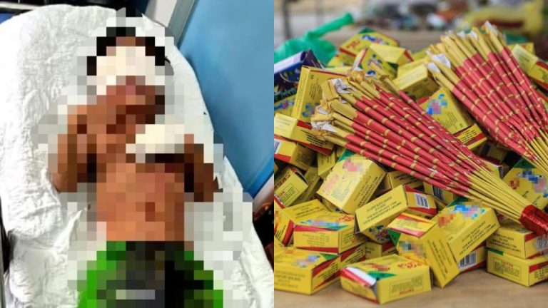 Main Mercun Punca Budak 4 Tahun Putus Beberapa Jari