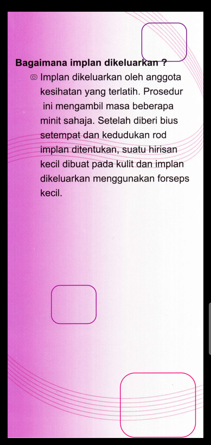 7 Perkara Tentang Implan Perancang Keluarga Yang Suami Pun Kena Ambil Tahu
